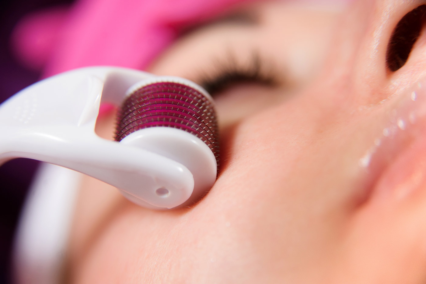 Everything you need to know about at-home Derma rolling - FashioNZ
