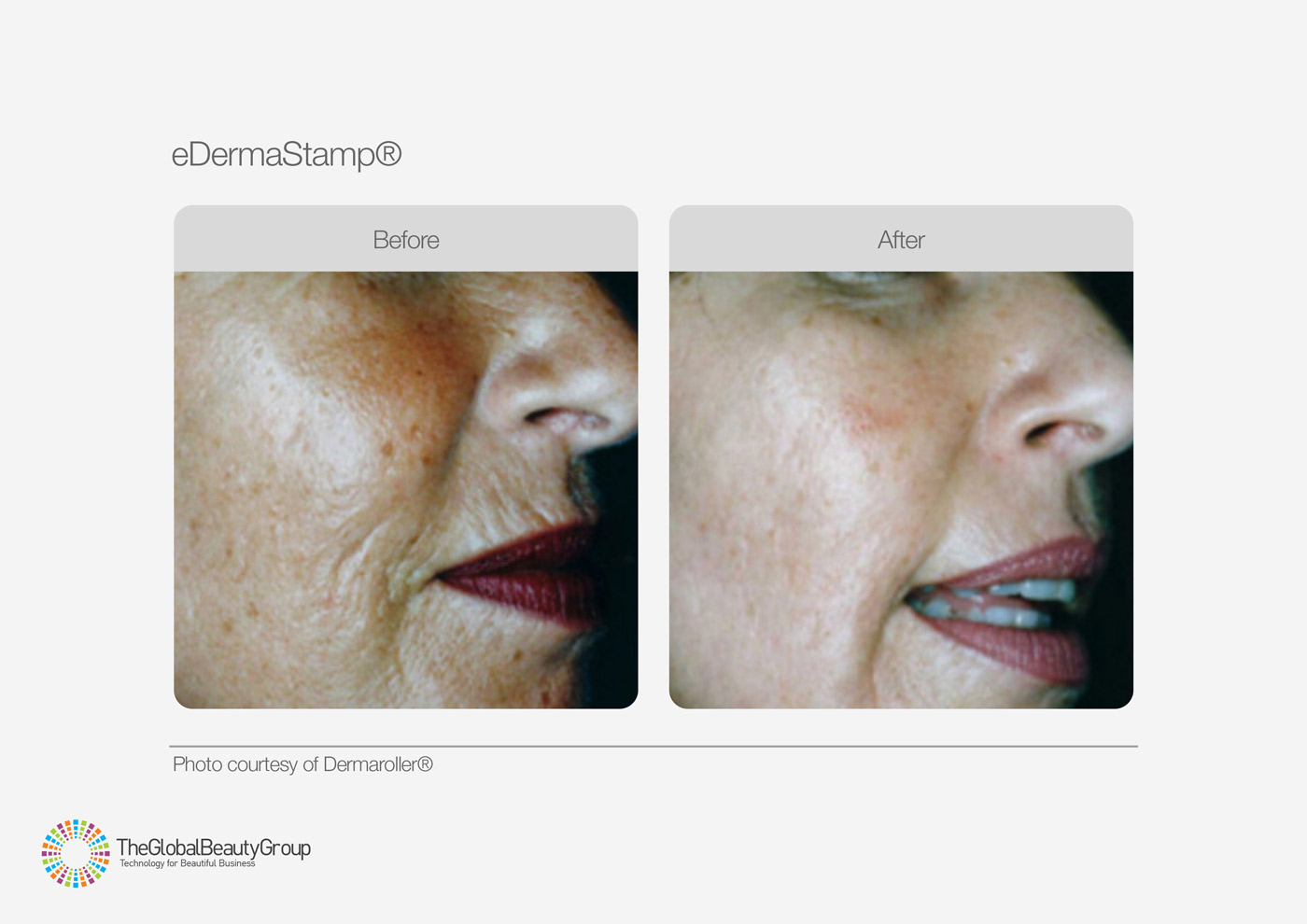 Tips and tricks to boost your skin’s collagen levels - FashioNZ
